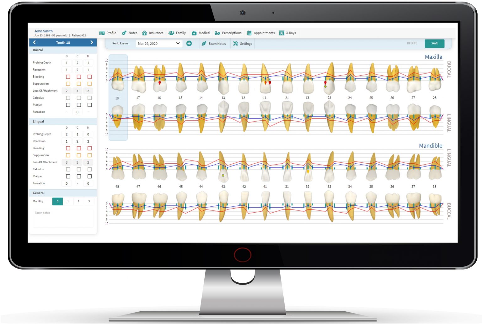 Advanced Perio – Akitu One